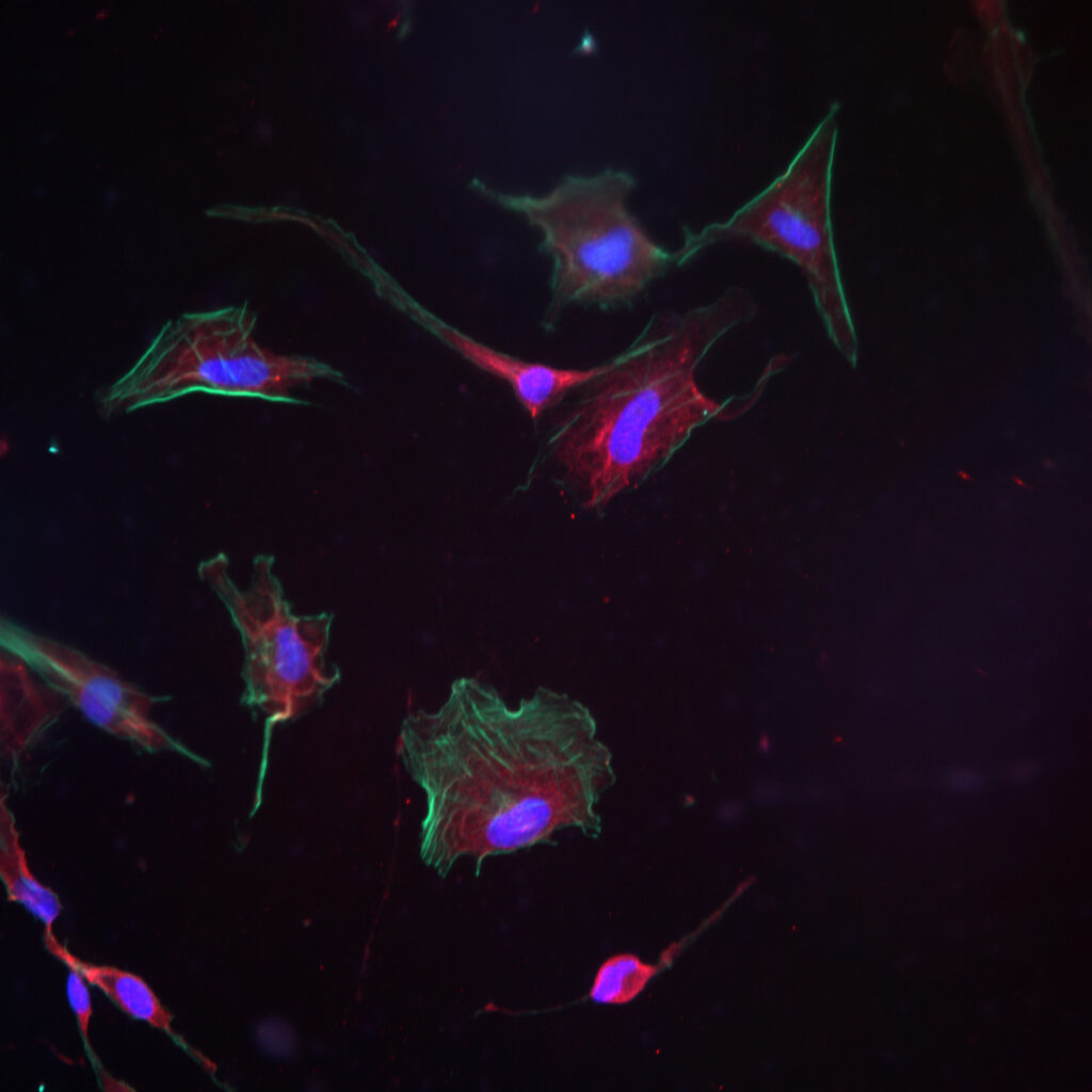 A Closer Look at Sinoveda’s Technology for Developing Combination Drugs – Sinoveda